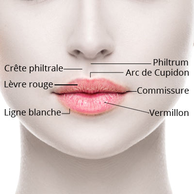 Redessiner les lèvres par l'injection d'acide hyaluronique - Médecine ...